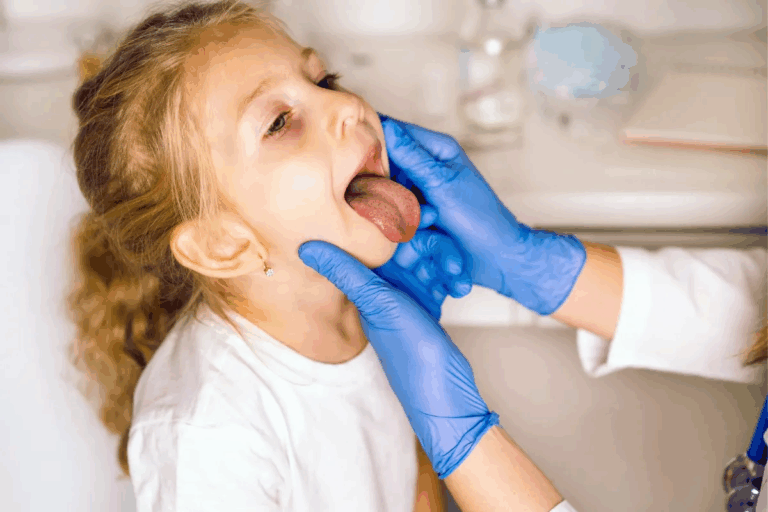 Tonsil Stone vs Strep: How to Tell the Difference - Liv Hospital