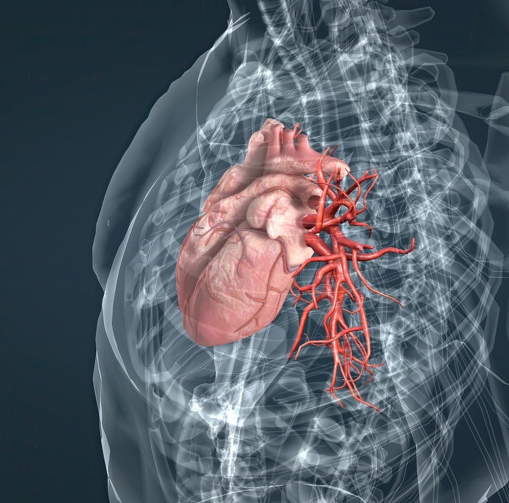7 Essential Angiogram Recovery Tips: Timeframes, Driving & Aftercare