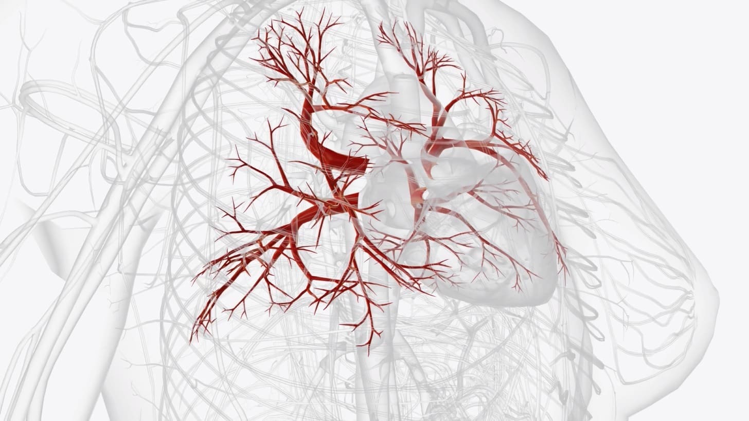 How Long Does It Take to Recover from an Angiogram and What Should You ...