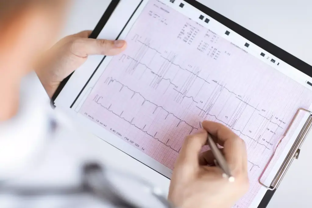 What Is Heart Sinus Rhythm and How Does It Define Normal Heart Function?