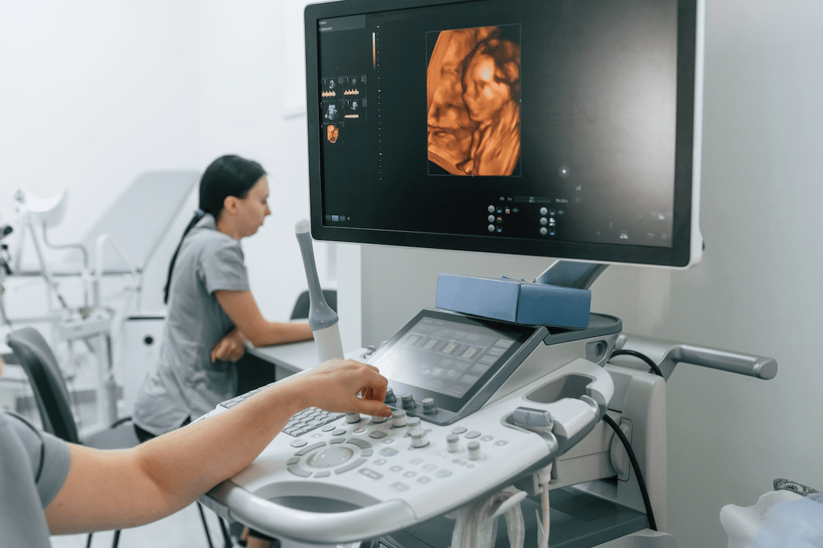Ultrasound of Gallbladder: 7 Essential Prep Steps - Liv Hospital