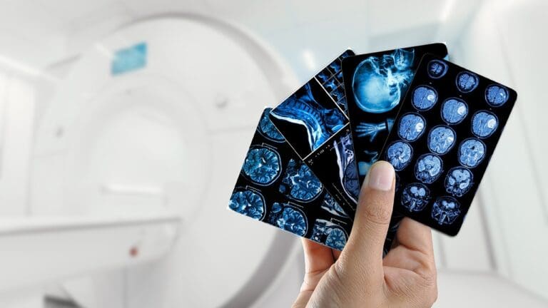 OCT-5648-How to Read Abnormal MRI Brain Reports: Step-by-Step ...