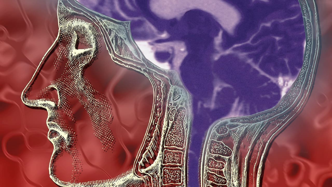 OCT-5625-What Is Acute Brain Infarction? Causes, Symptoms, and Meaning ...