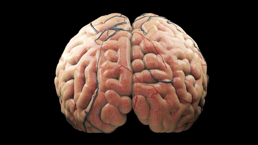 Brain Shunt Procedure: 7 Key Facts About Shunt Surgery and Lifelong Care