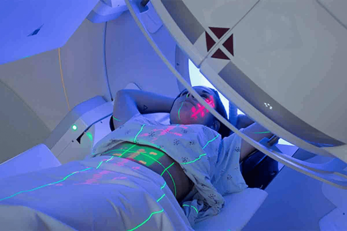 How to Get Radiation Out of Body: 5 Safe and Effective Ways - Liv Hospital