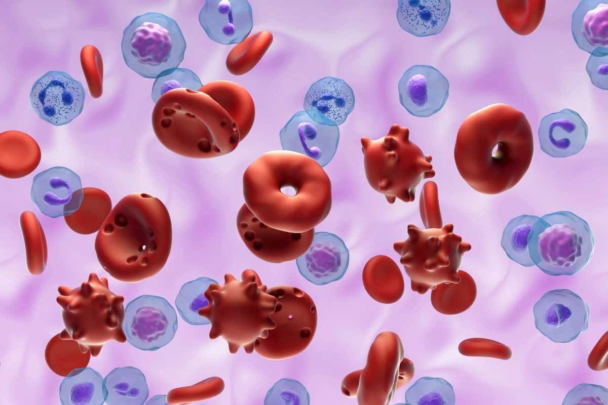 7 Different Types of Blood Clots: Names, Descriptions, and How They ...