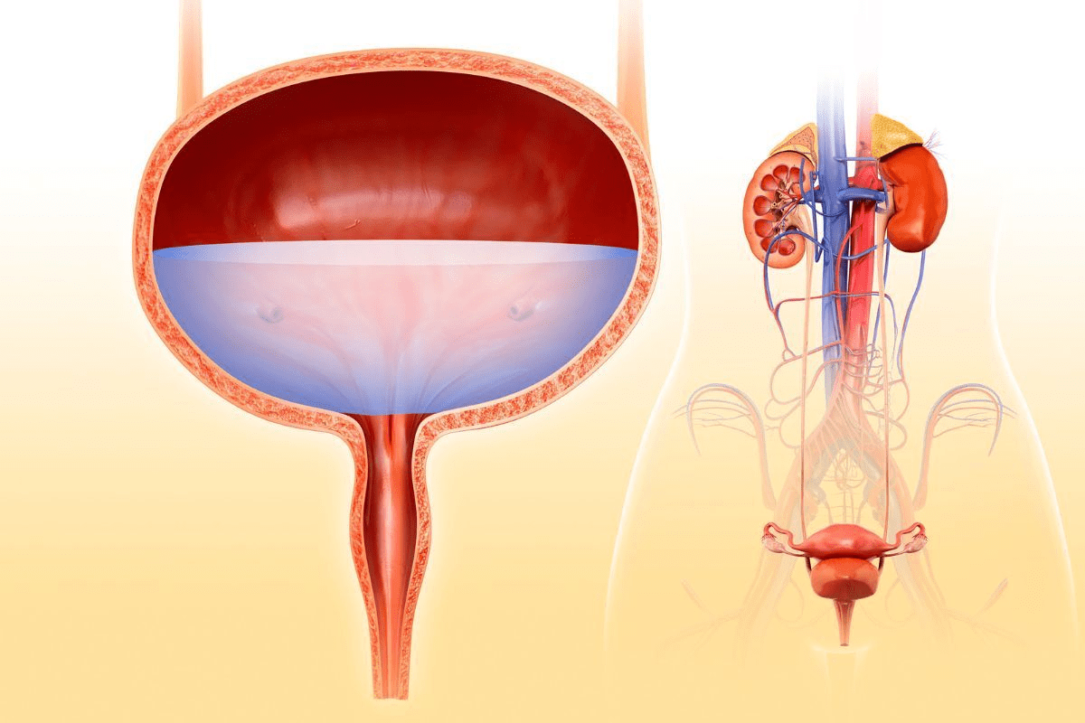 7 Proven Benefits of a Bladder Sling: A Lasting Solution for Bladder ...