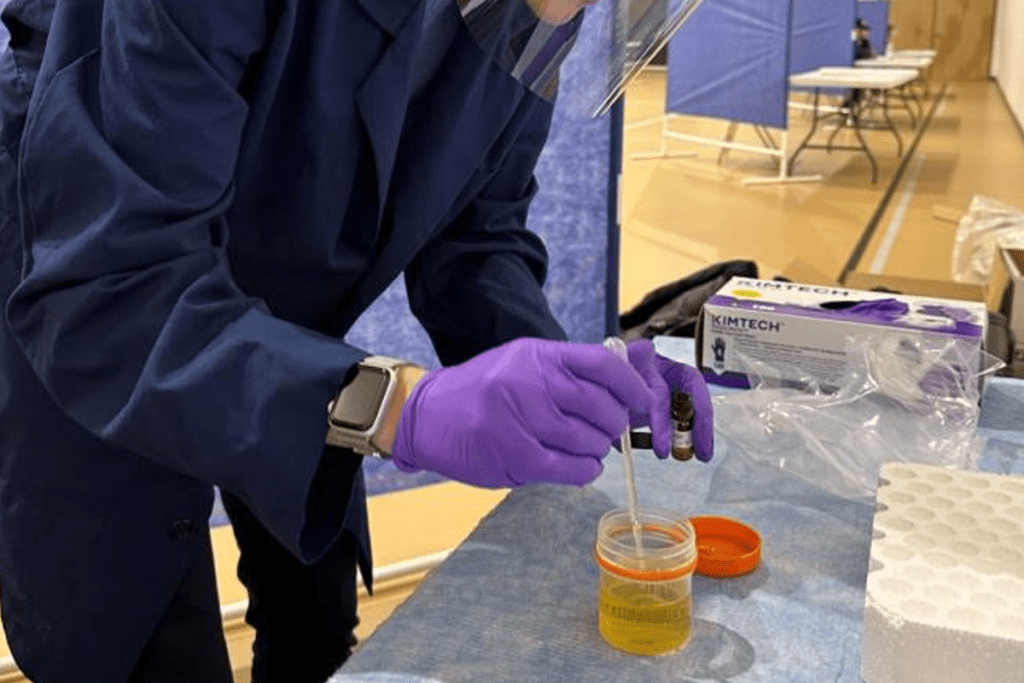 Abnormal PVR: What the PVR Medical Abbreviation Means - Liv Hospital