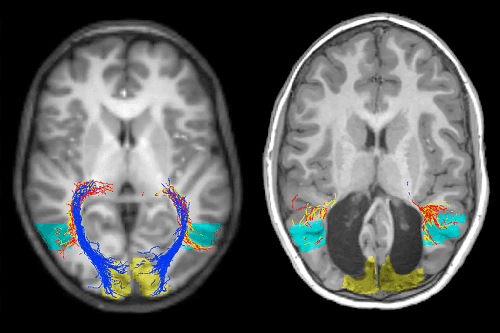 How Long Does an MRI Take: Understanding Scan Duration - Liv Hospital