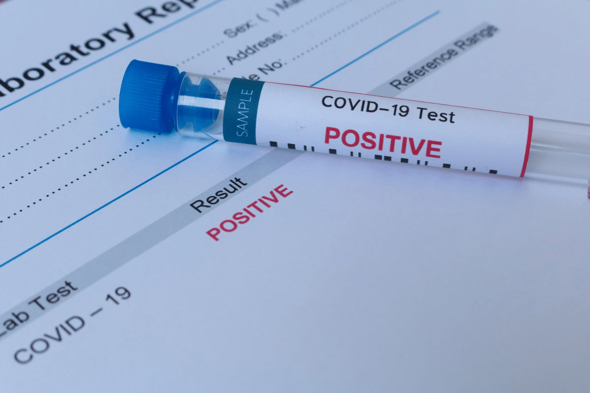 Guide What Does A Positive ANA Test Mean For Health? - Liv Hospital