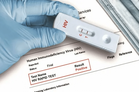 Guide What Does A Positive ANA Test Mean For Health? - Liv Hospital