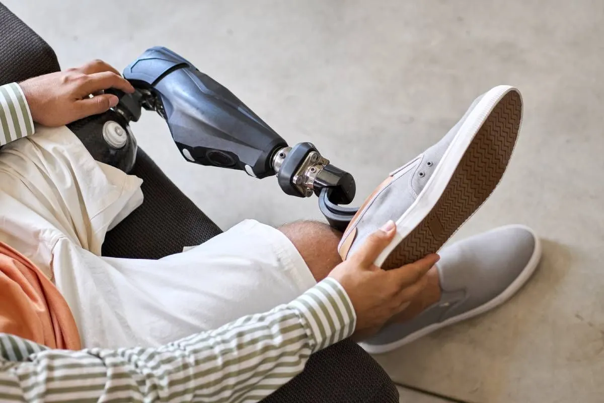 Essential Osseointegrated Prosthetic Limb Technology Explained - Liv ...