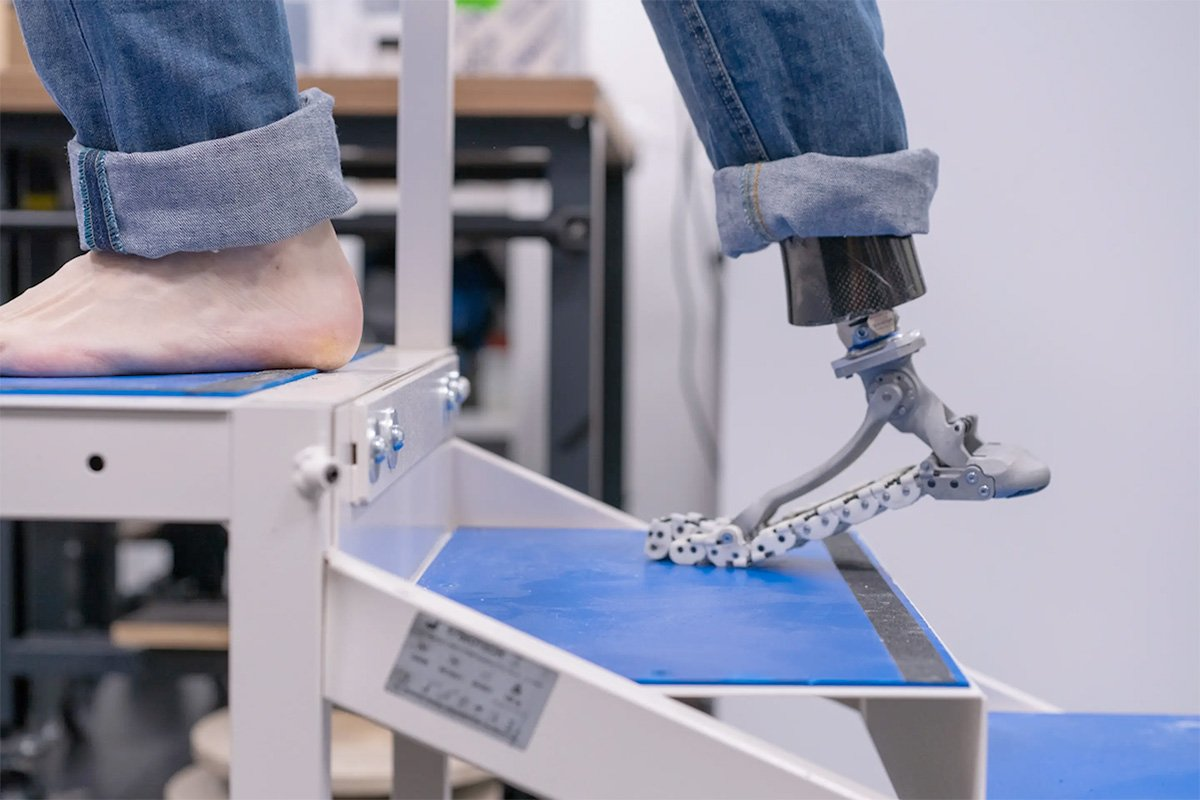 Sharp Choose Metal Prosthetic Leg Materials Effectively - Liv Hospital