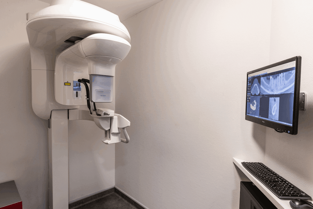 How To Get A 3D Cone Beam Scan: Complete Guide - Liv Hospital
