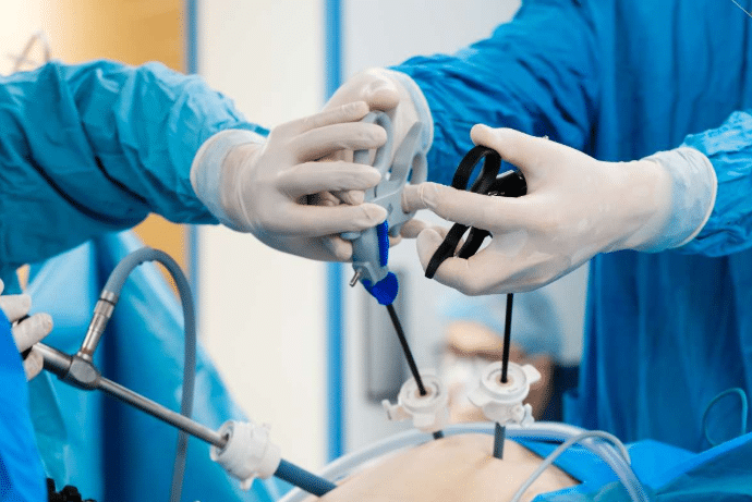 Oxygen Laparoscopy Contraindication: Fire - Liv Hospital